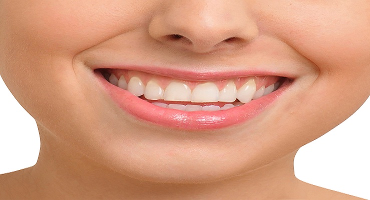 Smile Makeover: Cosmetic Fix for Damaged Teeth